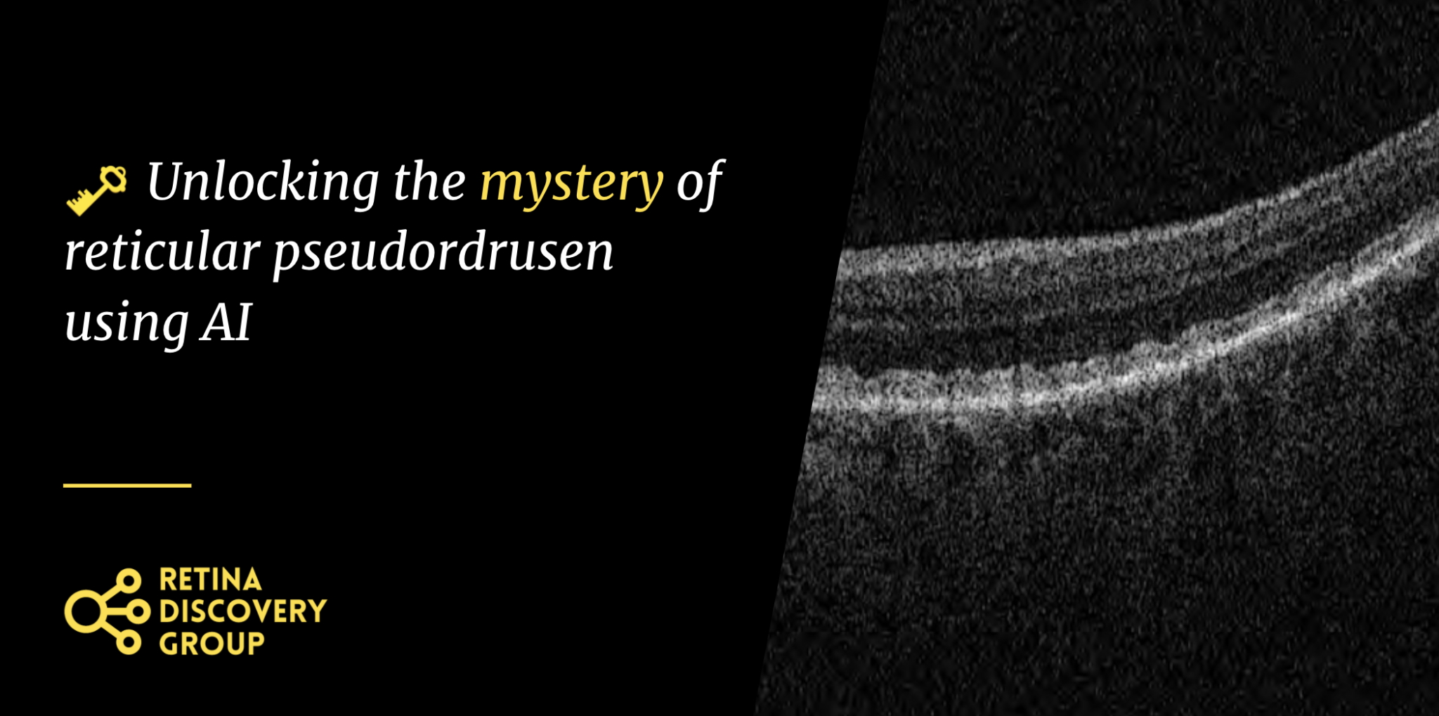 RPD – Retina Discovery Group